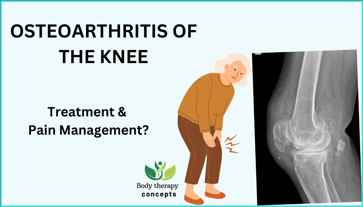 Osteoarthritis of the knee: what is the treatment & pain management?