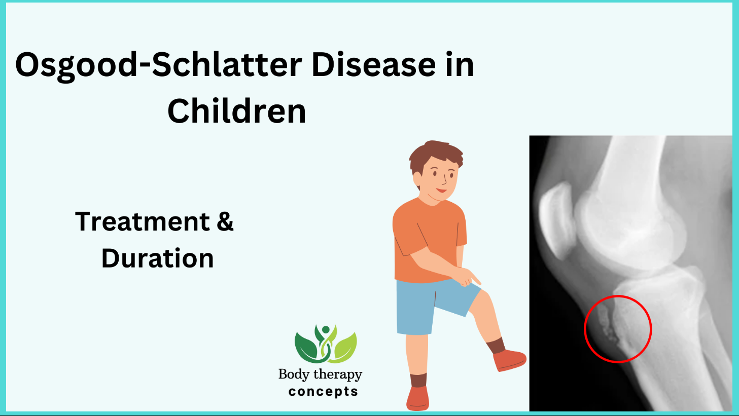 How is Osgood-Schlatter disease treated & duration?