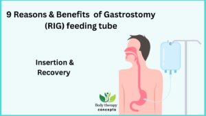 Gastrostomy (RIG) feeding tube insertion, reasons ,benefits and recovery.