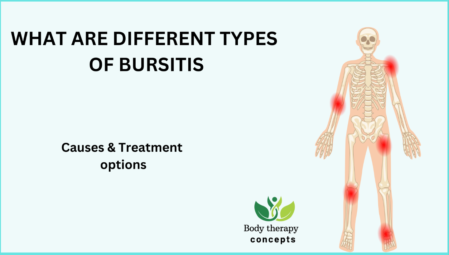 How long does it take for bursitis to heal?