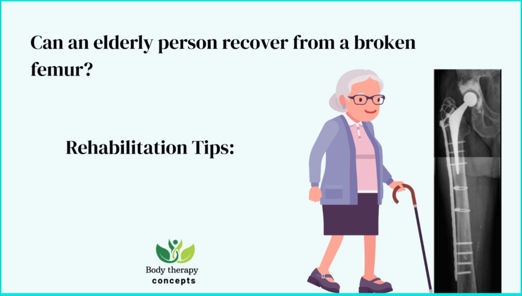 Can an elderly person recover from a broken femur? Rehabilitation Tips:
